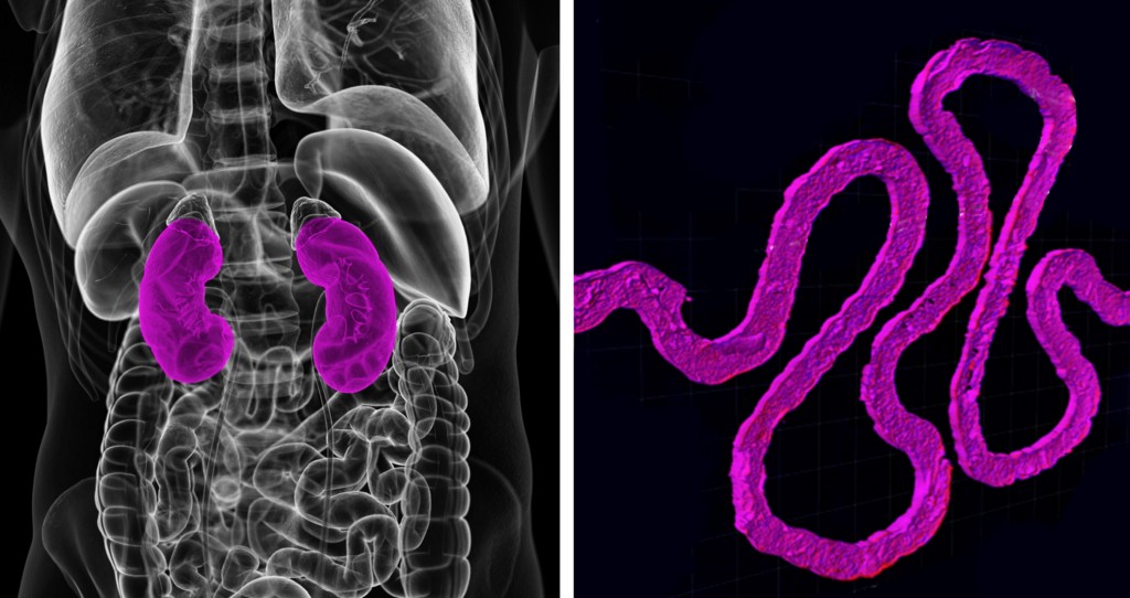 What Will It Take to 3-D Print Organs? - proto.life